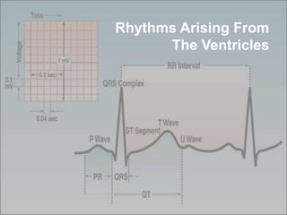 An overview of paediatric ECG | PDF