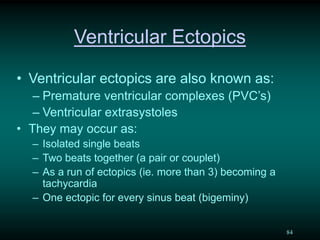 An overview of paediatric ECG | PDF