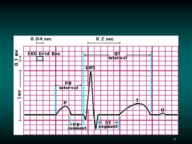 An overview of paediatric ECG | PDF