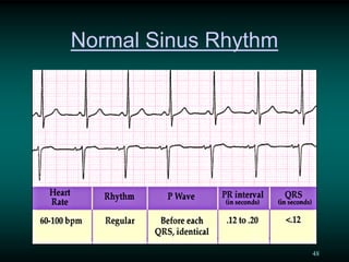 Normal Pediatric Ecg