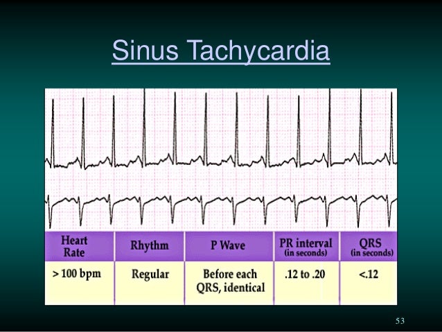 An overview of paediatric ECG