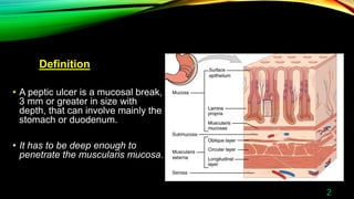 Treatments for PEPTIC ULCER | PPTX | Digestive Disorders | Diseases and ...