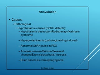 anovulation (2).pptx