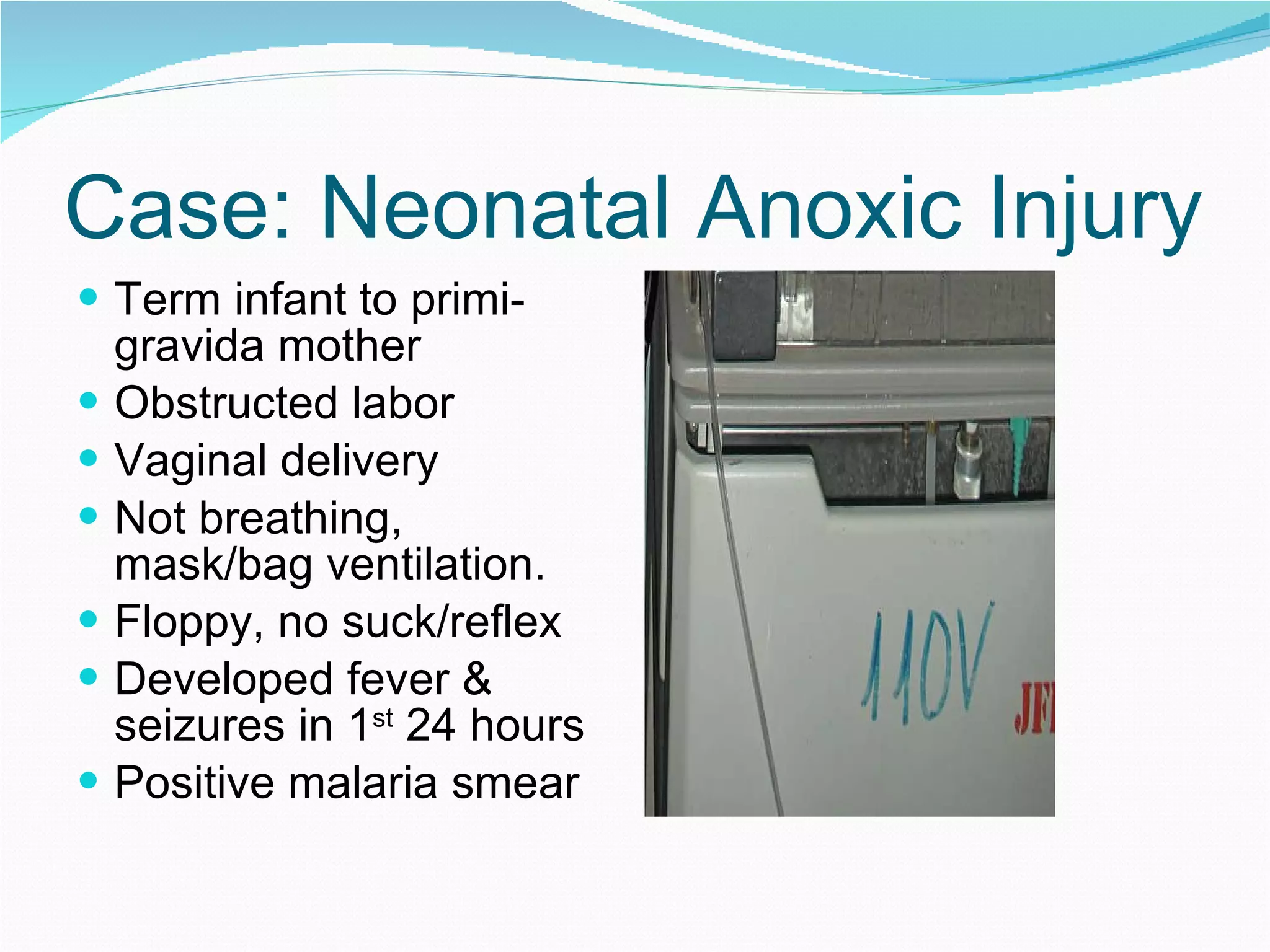 Anoxic brain injury | PPT