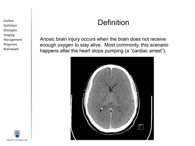 Anoxic brain injury and braindeath info for patient's families | PPT