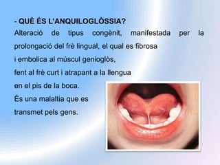Anquiloglòssia | PPTX