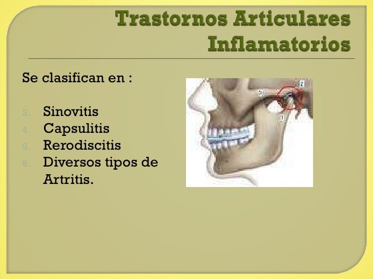Anquilosis Atm Imagenteo (2)