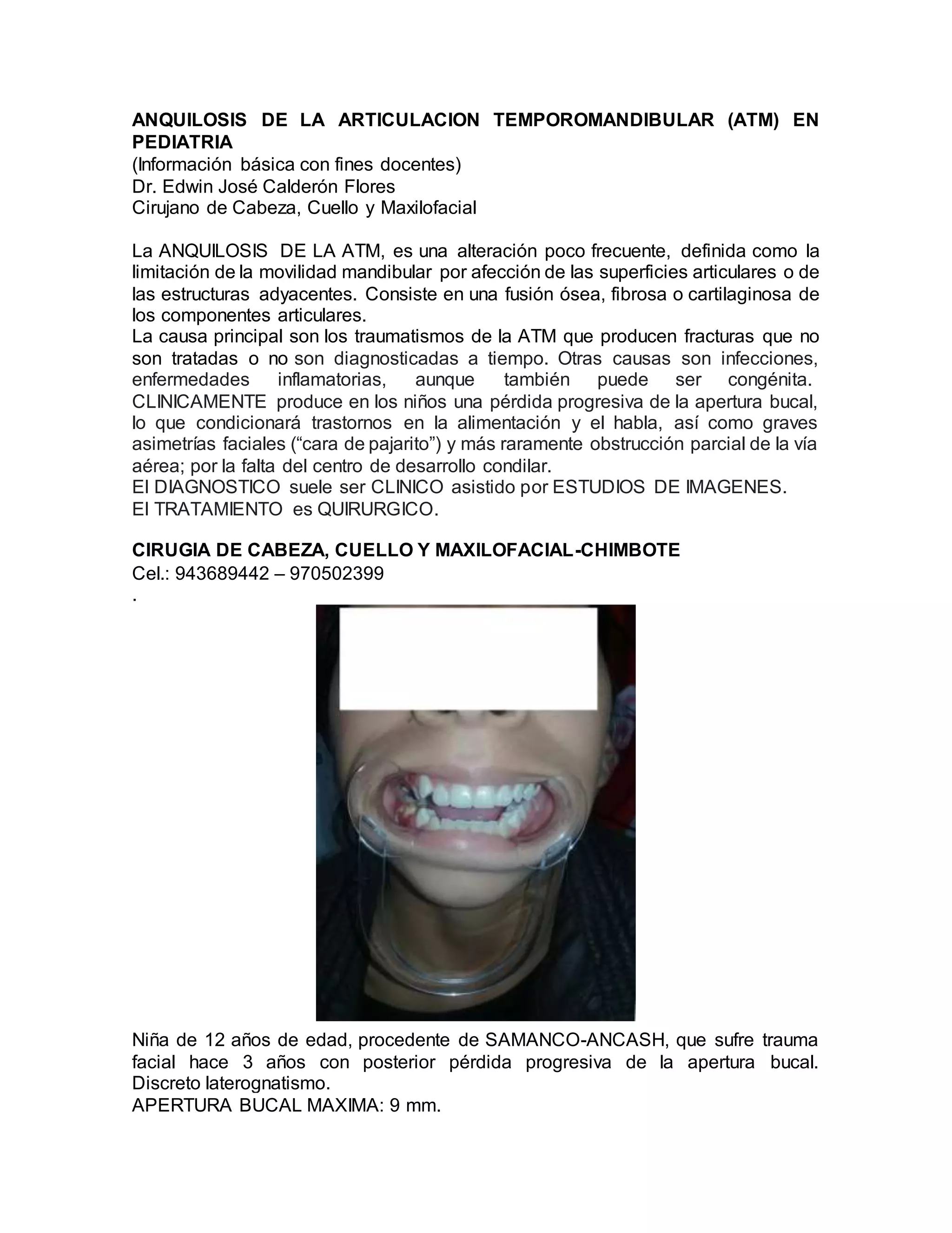ANQUILOSIS DE LA ARTICULACION TEMPOROMANDIBULAR (ATM) EN PEDIATRIA ...