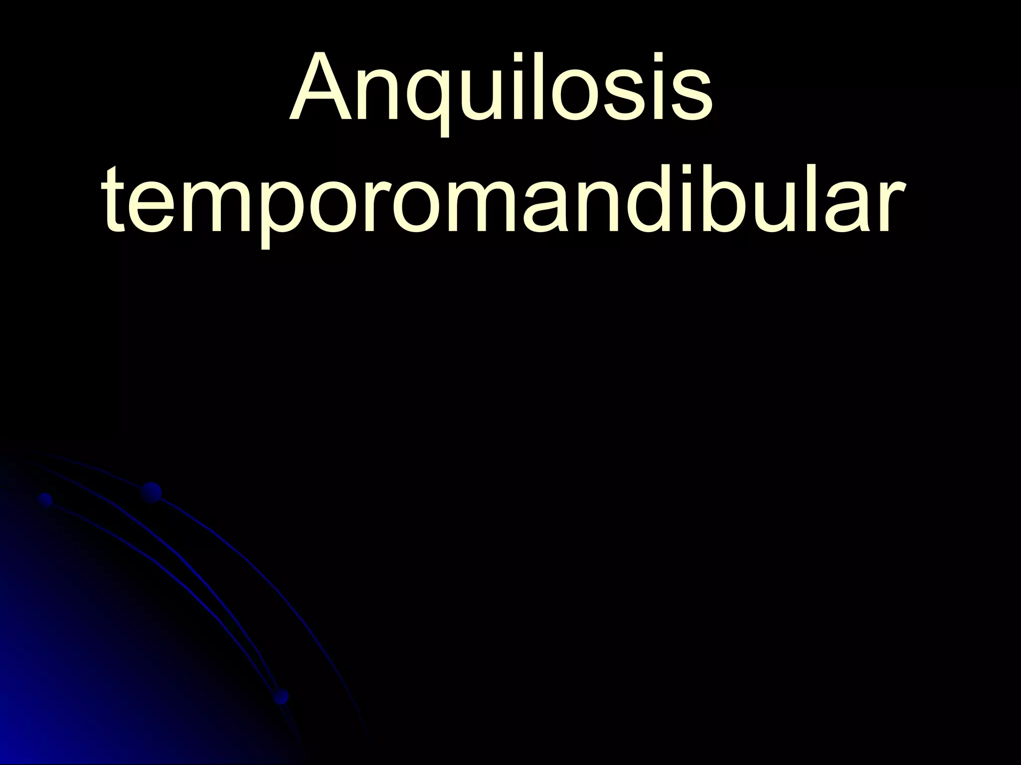 Anquilosis temporomandibular | PPT