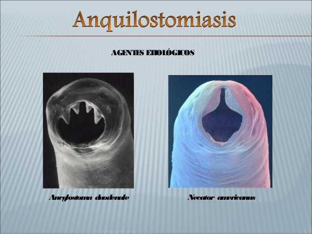 Anquilostomiasis y Larva Migrans Cutánea