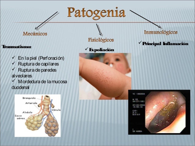 Anquilostomiasis y Larva Migrans Cutánea