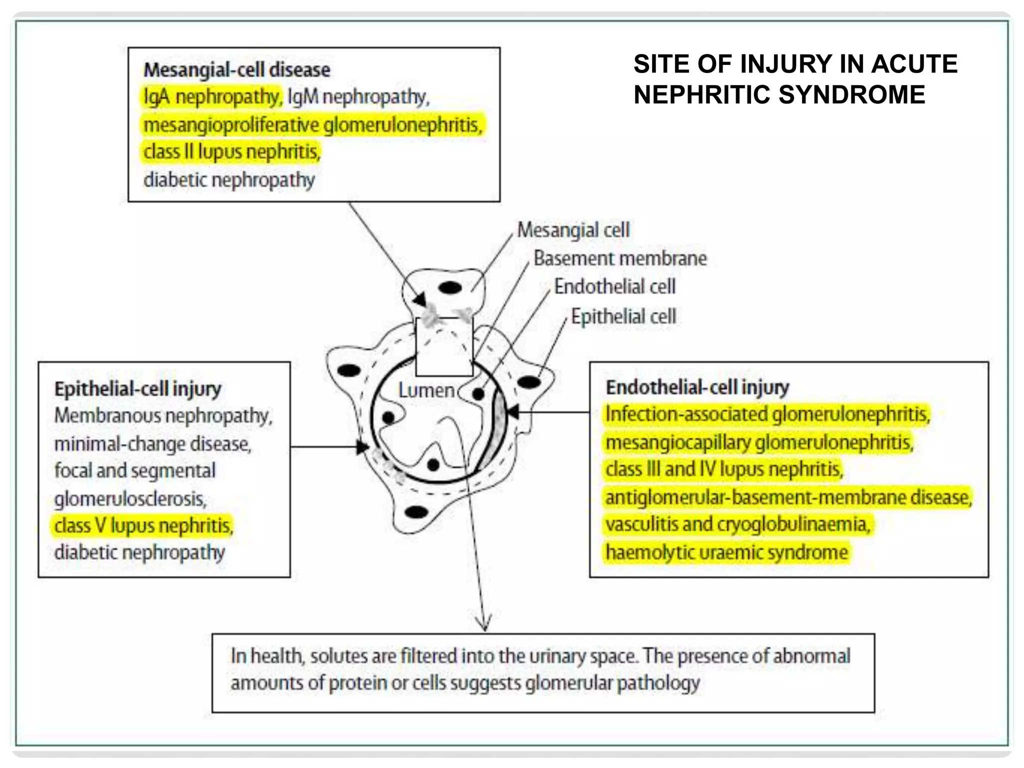 Acute Nephritic Syndromes | PPTX