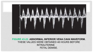 Obstetric Colour Doppler Study | PPT