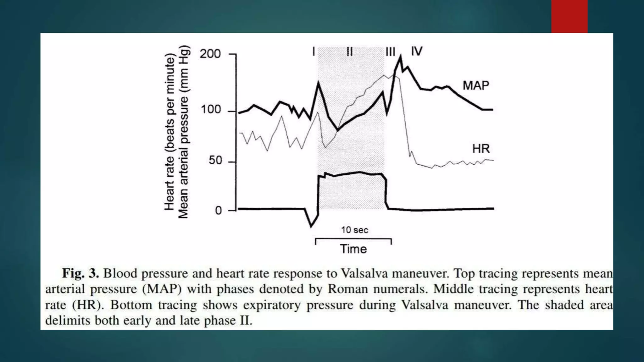 Autonomic nervous system testing arfa sulthana | PPT