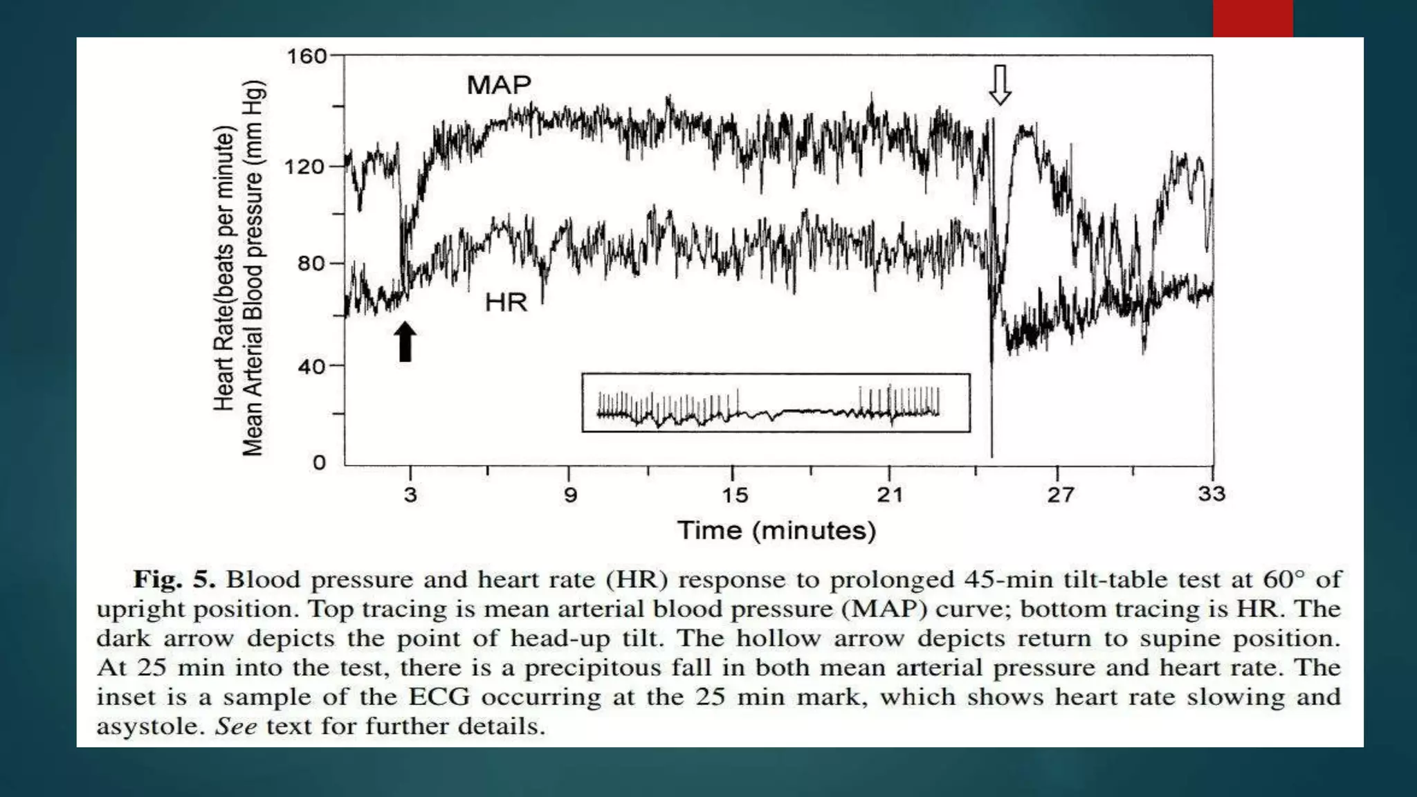 Autonomic nervous system testing arfa sulthana | PPT