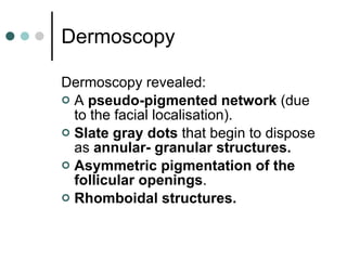 Dermoscopy. Lentigo Maligna Melanoma. | PPT