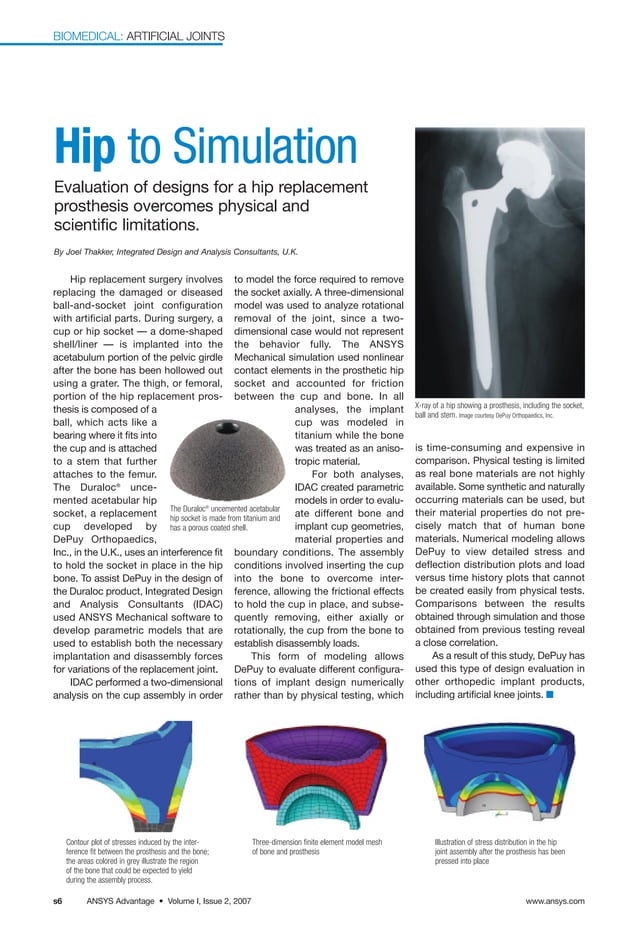 A N S Y S Biomedical Industry | PDF