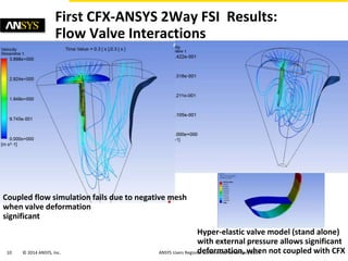 Simulations of Hypertrophic Obstructive Cardiomyopathy (HOCM) in a Human Heart Left Ventricle ...