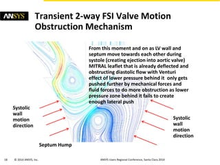 Simulations of Hypertrophic Obstructive Cardiomyopathy (HOCM) in a ...
