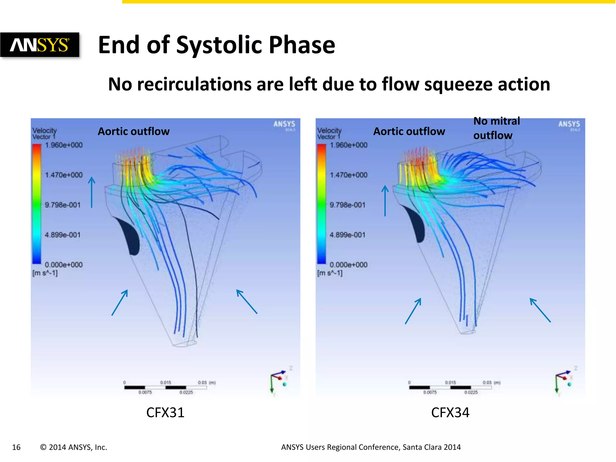 Simulations of Hypertrophic Obstructive Cardiomyopathy (HOCM) in a Human Heart Left Ventricle ...