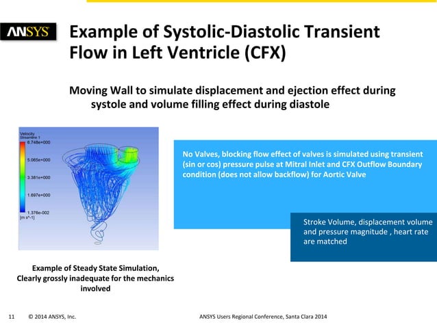 Simulations of Hypertrophic Obstructive Cardiomyopathy (HOCM) in a Human Heart Left Ventricle ...