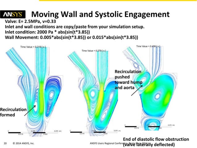 Simulations of Hypertrophic Obstructive Cardiomyopathy (HOCM) in a ...