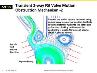 Simulations of Hypertrophic Obstructive Cardiomyopathy (HOCM) in a ...