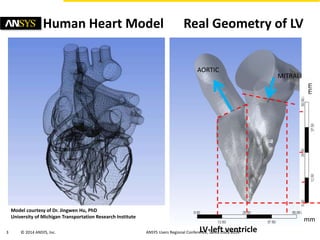 Simulations of Hypertrophic Obstructive Cardiomyopathy (HOCM) in a Human Heart Left Ventricle ...