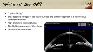Anterior Segment OCT in Ophthalmology | PDF