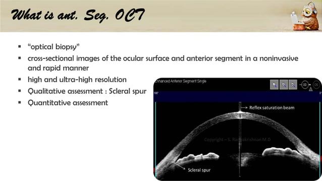 Anterior Segment OCT in Ophthalmology | PDF | Science