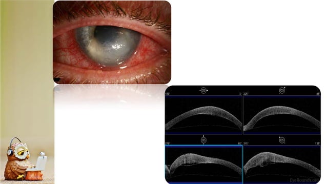 Anterior Segment OCT in Ophthalmology | PDF | Science