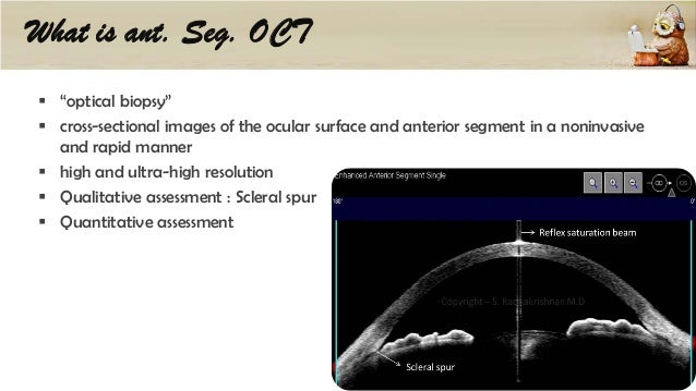 Anterior Segment OCT in Ophthalmology