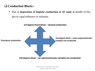 Ant arrhythmic drugs | PPT