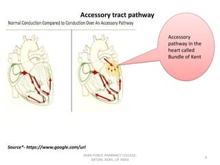 Ant arrhythmic drugs | PPT
