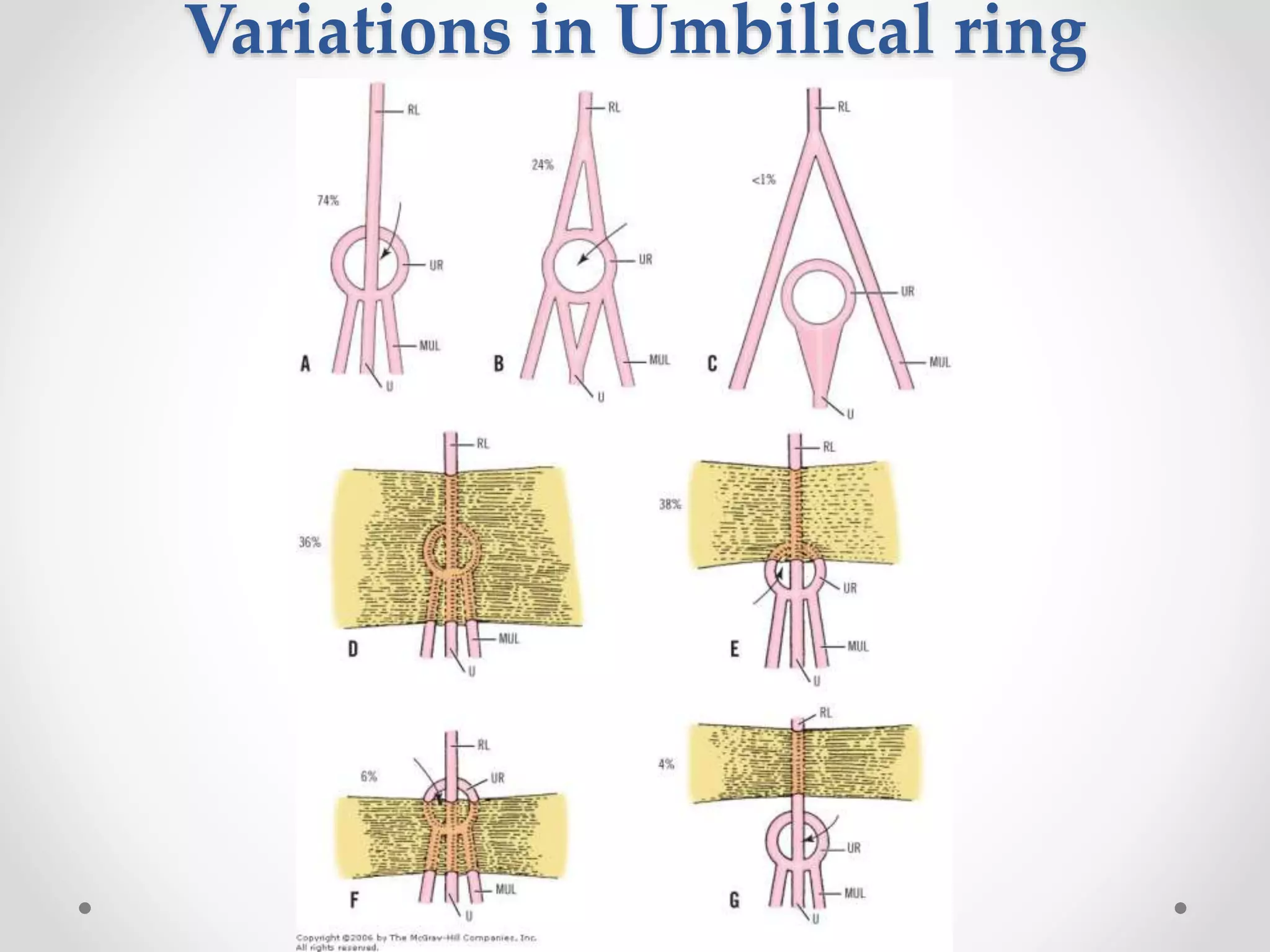 Surgical Anatomy of anterior abdominal wall | PPTX