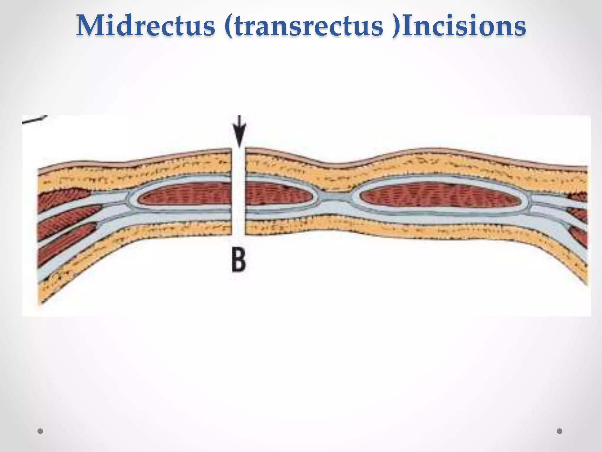 Surgical Anatomy of anterior abdominal wall | PPTX