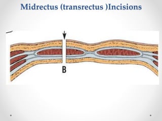 Surgical Anatomy of anterior abdominal wall | PPTX