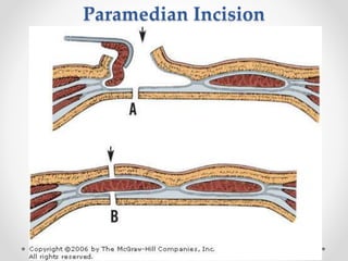 Surgical Anatomy of anterior abdominal wall | PPT
