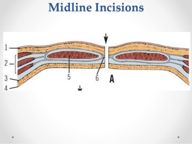 Surgical Anatomy of anterior abdominal wall