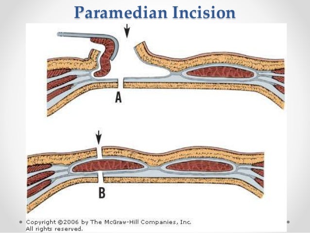 Surgical Anatomy of anterior abdominal wall