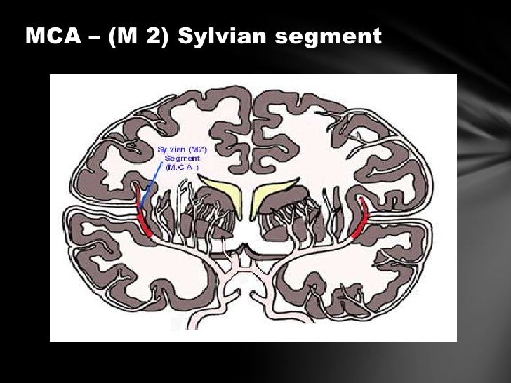 Anterior cerebral circulation