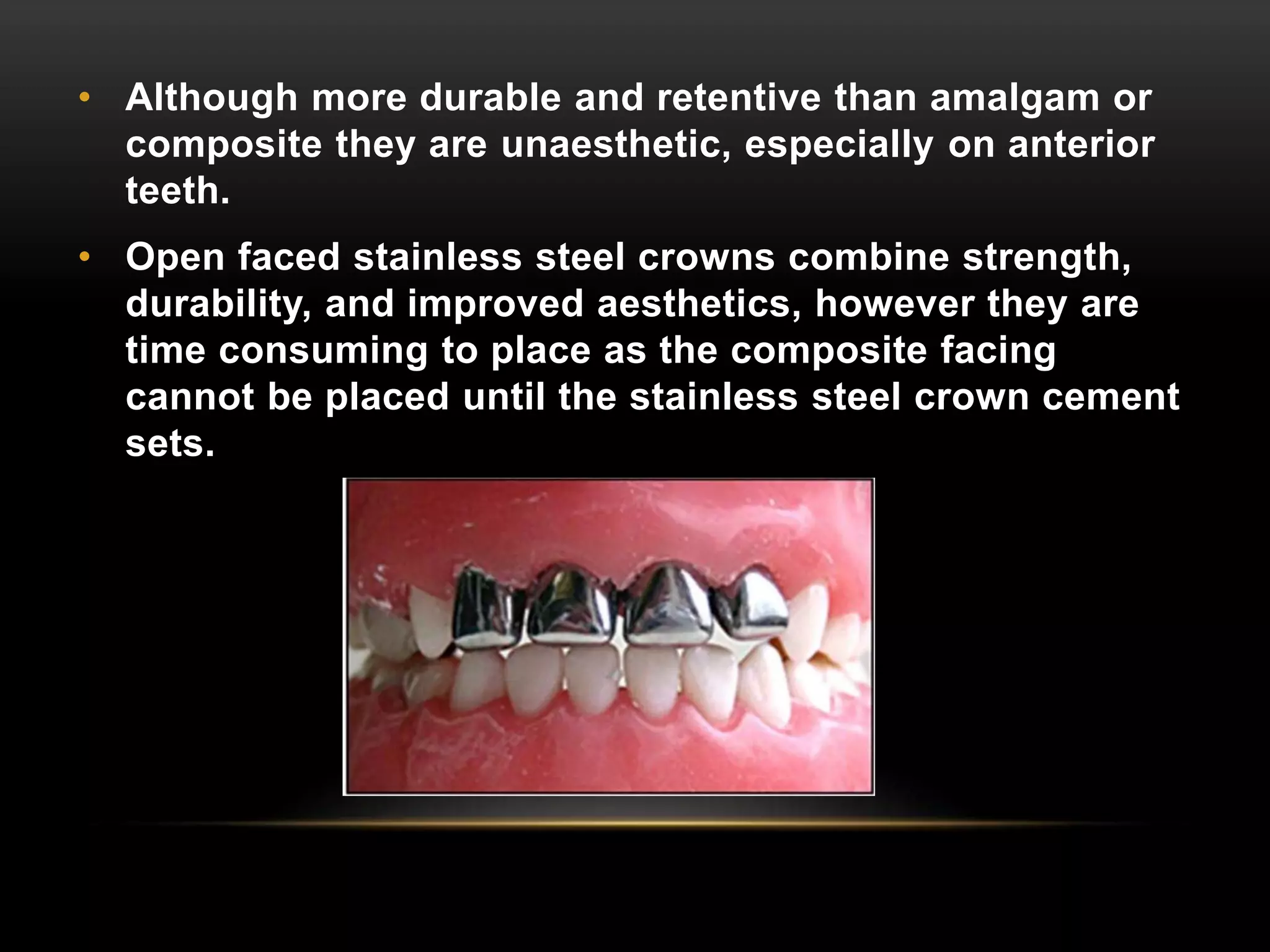 Anterior crowns in pediatric dentistry | PPTX