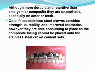 Stainless steel crowns in pediatric dentistry | PPTX