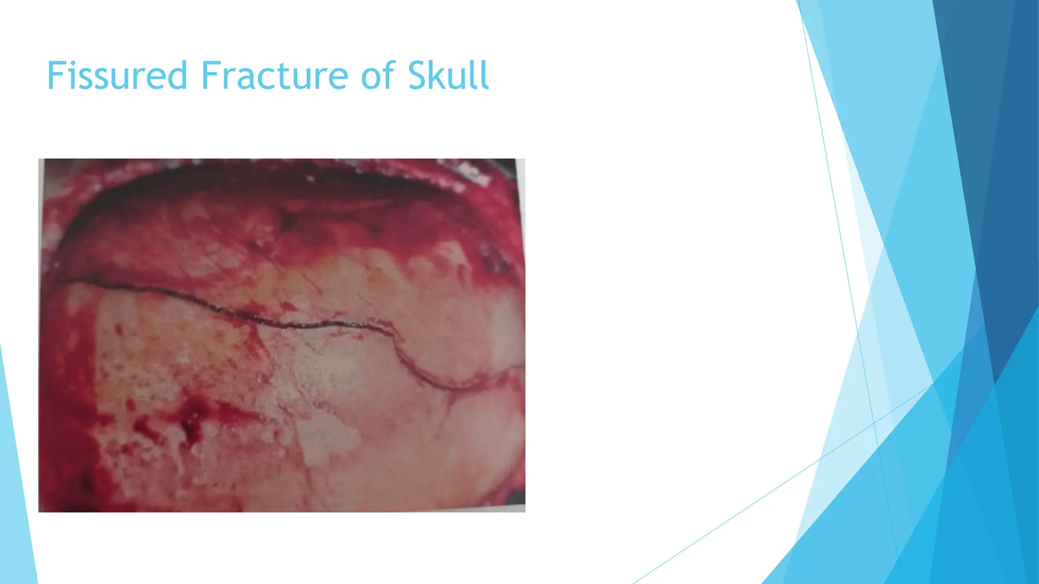 Ante-mortem and Post-mortem injuries - Copy.pdf