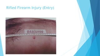 Ante-mortem and Post-mortem injuries - Copy.pdf