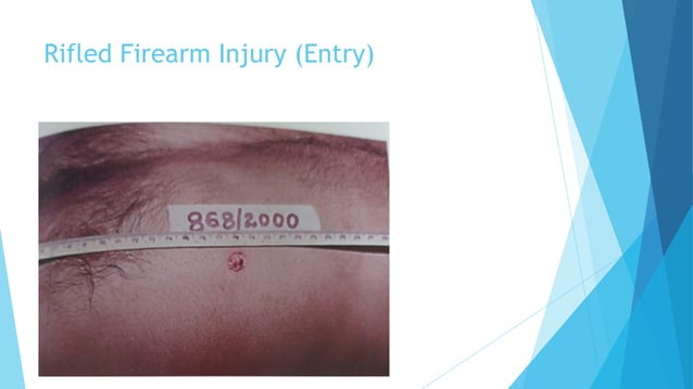Ante-mortem and Post-mortem injuries - Copy.pdf