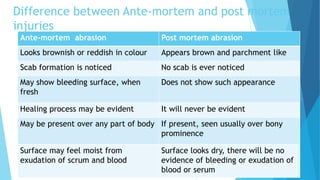 Ante-mortem and Post-mortem injuries - Copy.pdf