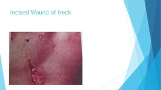 Ante-mortem and Post-mortem injuries - Copy.pdf