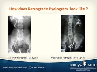 Antegrade and retrograde pyelography | PPTX