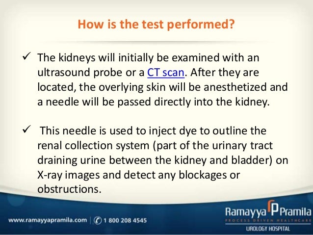 anterograde vs retrograde